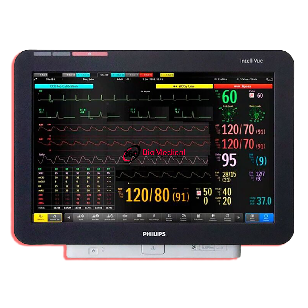 Philips IntelliVue MX800 – 360biomedical